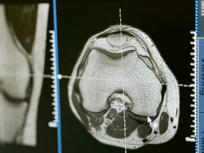 Échographie cardiaque : déroulement, indications et résultats - EchoFirst